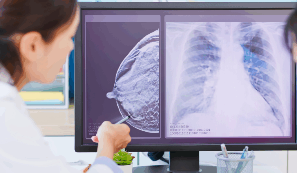 What Type of Collagen Causes Breast Cancer?